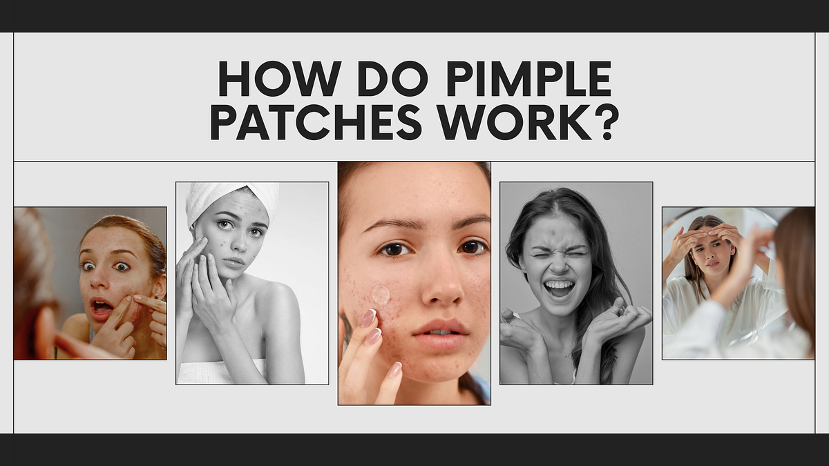 How Do Pimple Patches Work? A Quick Guide | by Julia Grace Cook | Jul ...
