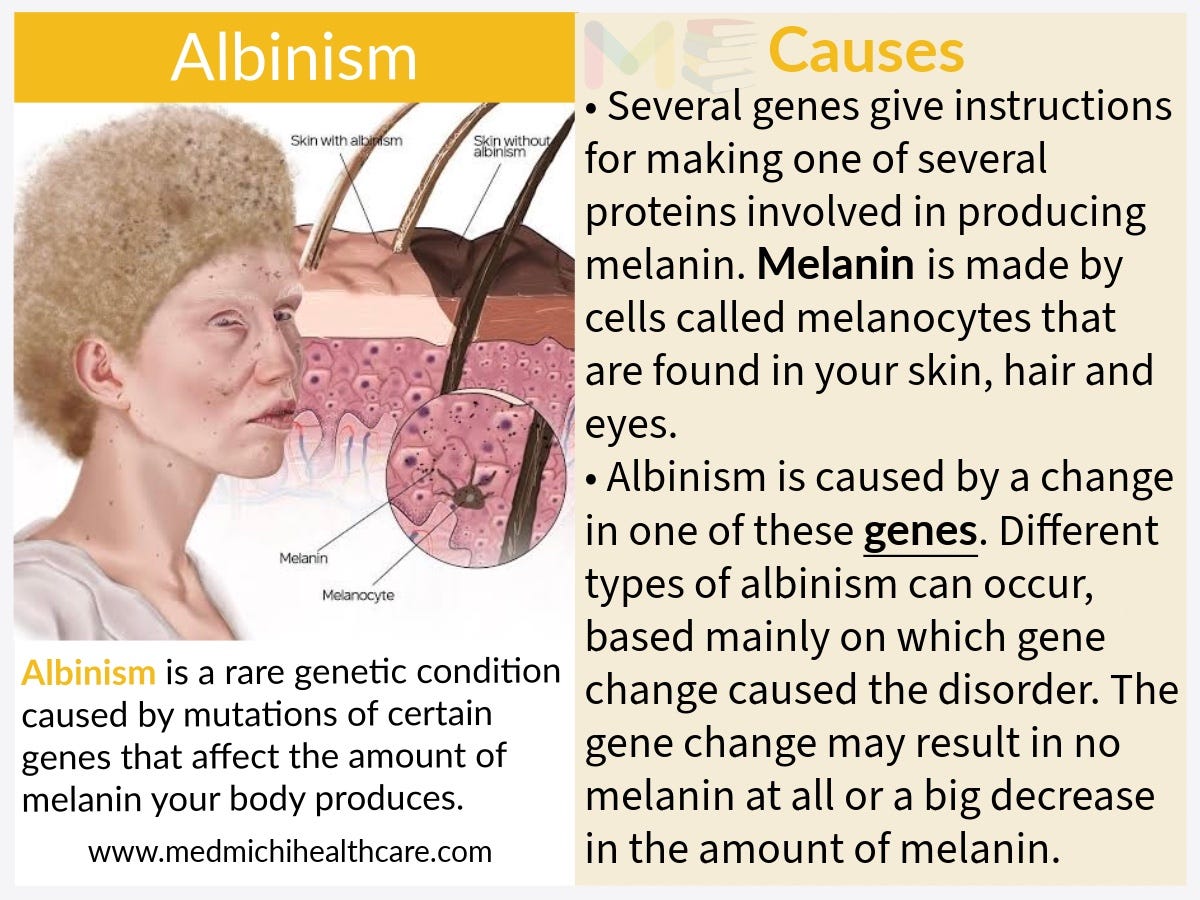 Albinism causes - Medmichihealthcare.com - Medium