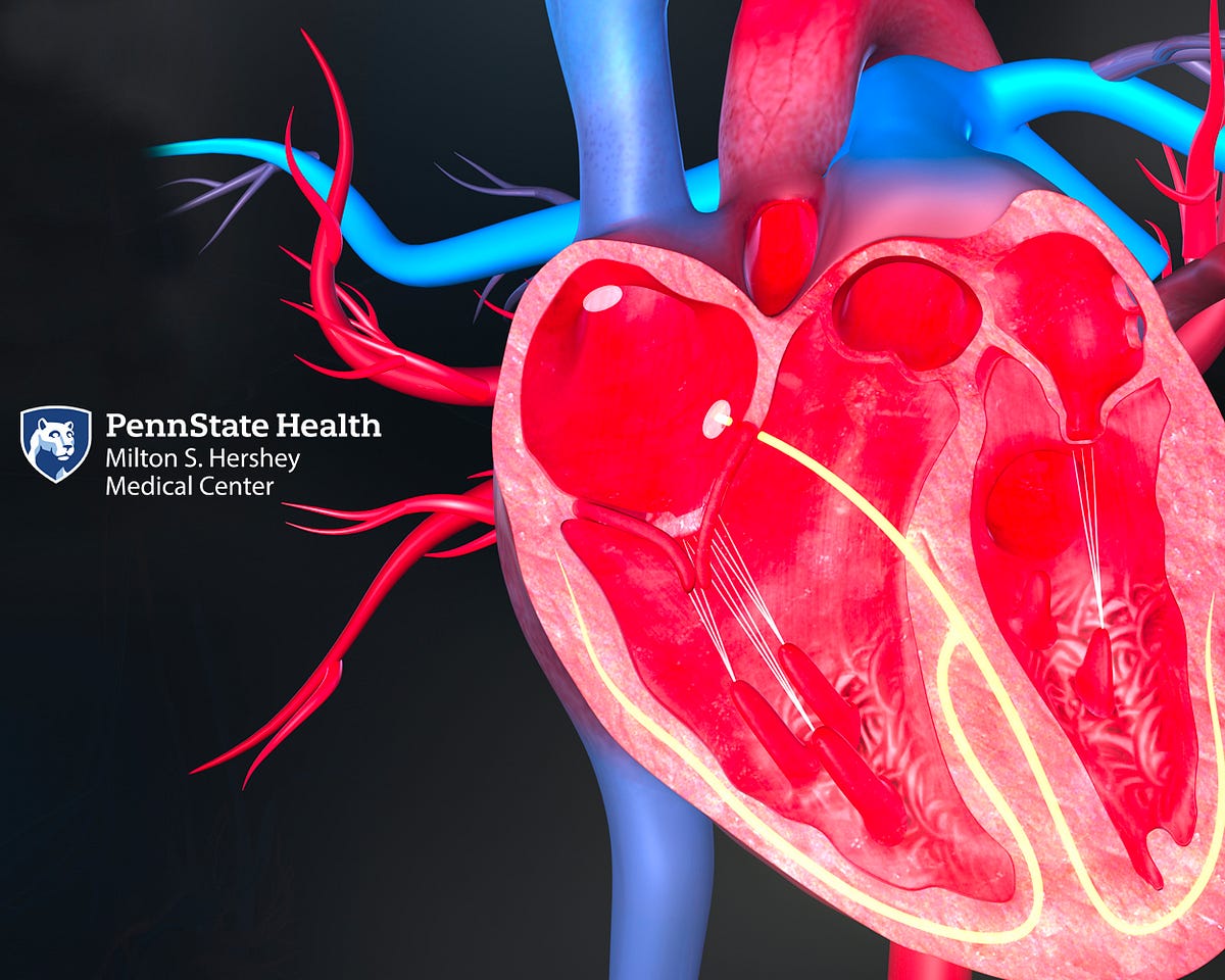 Minimally invasive treatments for structural heart disease | by Penn ...