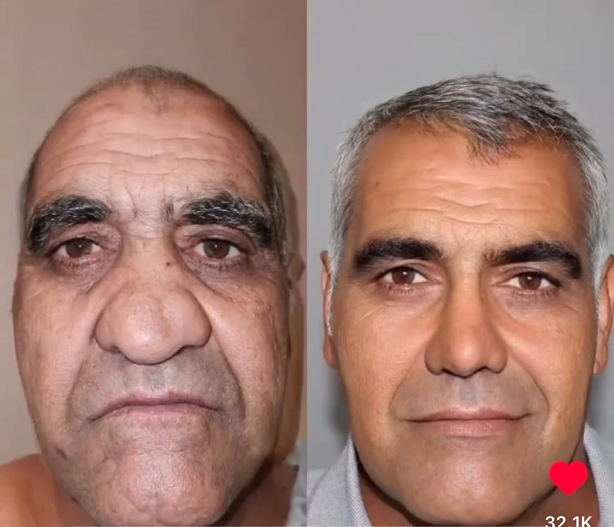 Iran’s Leading Cosmetic Surgeons: A Closer Look | by Sean Ra ☀️🌜💞🌛 ...