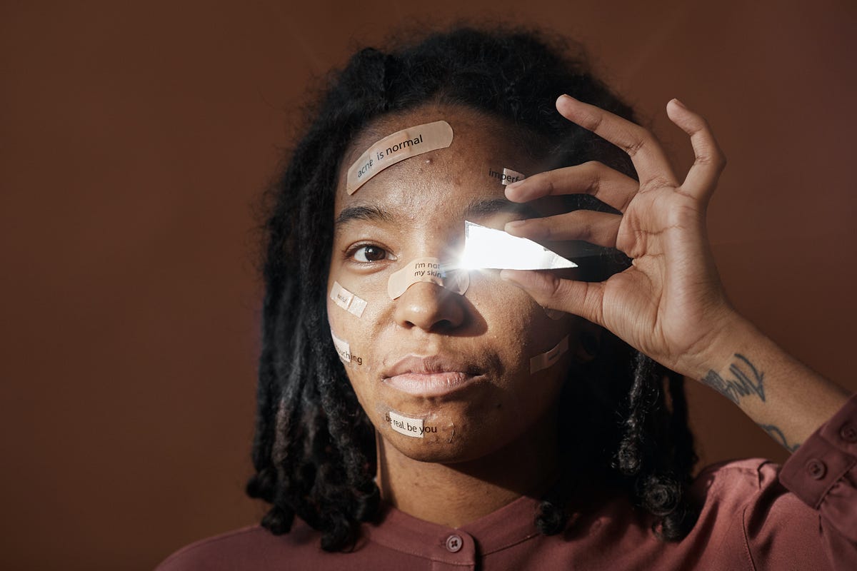 How to Get Rid of Blind Pimples: Effective Tips and Remedies | by Marie ...