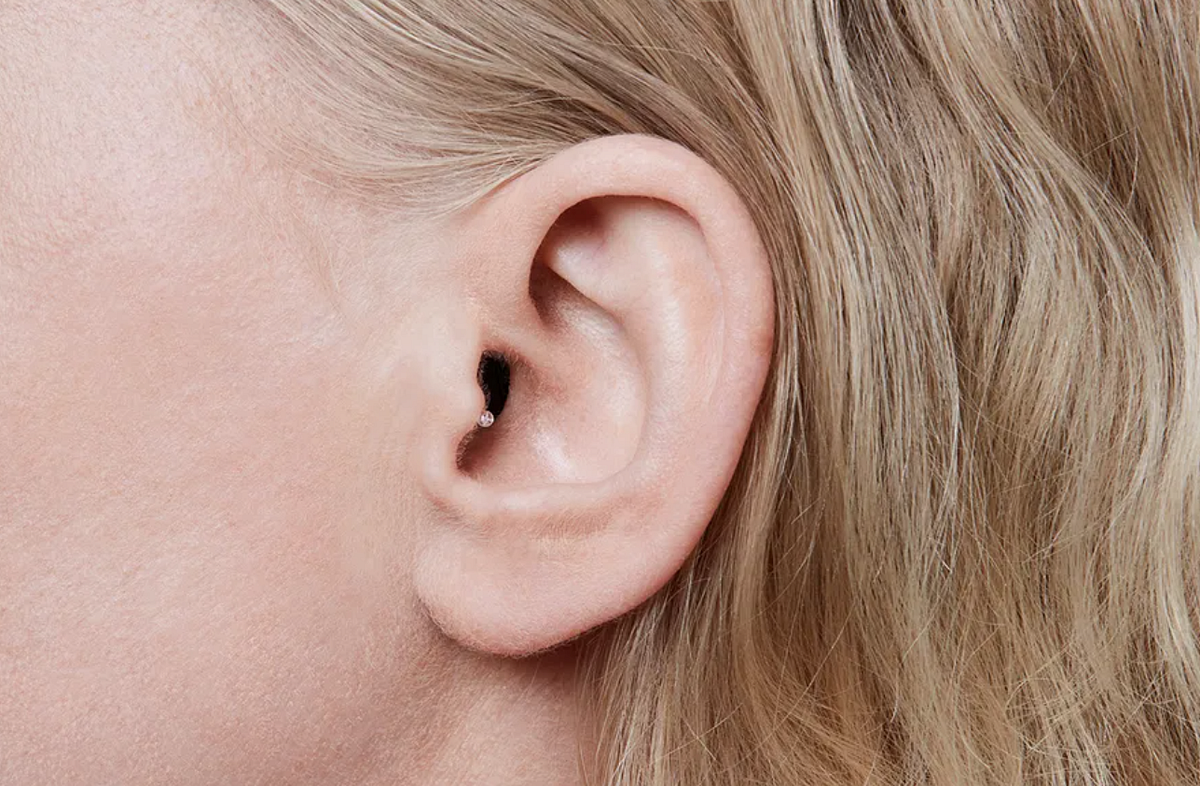 Is the rise of In the Ear — ITE Style Hearing Aid a revolutionary leap ...