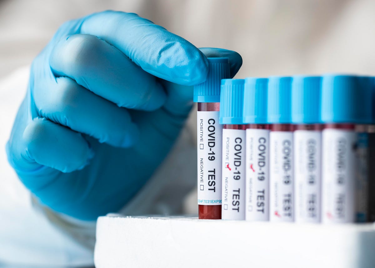 Reliable Blood Test Centers in Chandigarh: Why Sanjivini Diagnostics Is ...