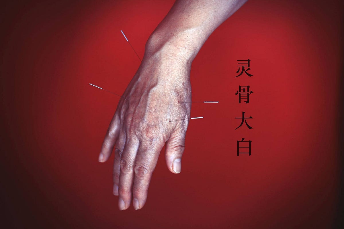Ling Gu Da Bai. 灵骨 大白 | by Art of Acupuncture | Medium