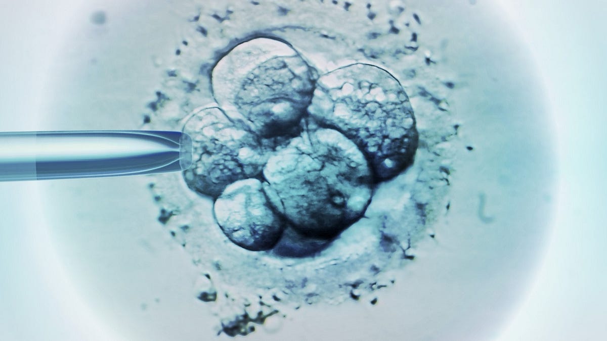Single Embryo Transfer: Increasing Success Rates at Audubon Fertility ...
