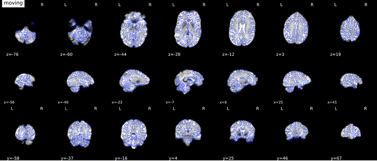 Identifying Resting-State Networks from fMRI Data Using ICAs | by Gili ...