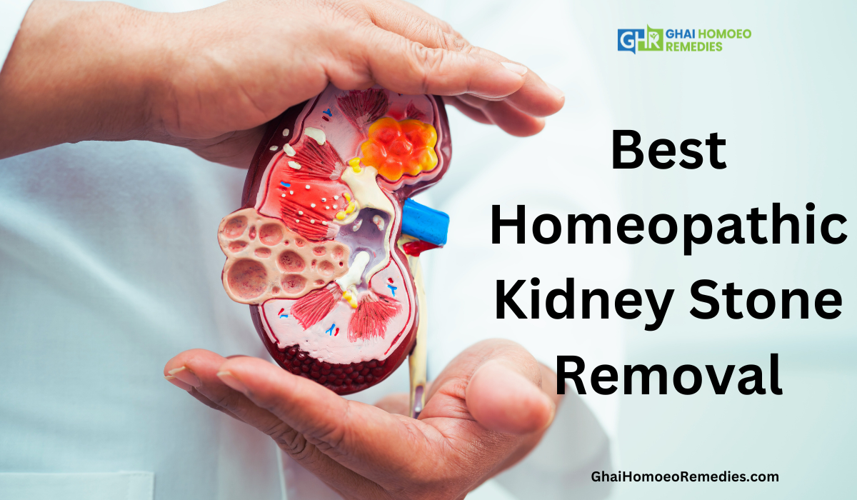 Now Choose The Best Kidney Stone Removal | by Ghai homoeo remedies ...