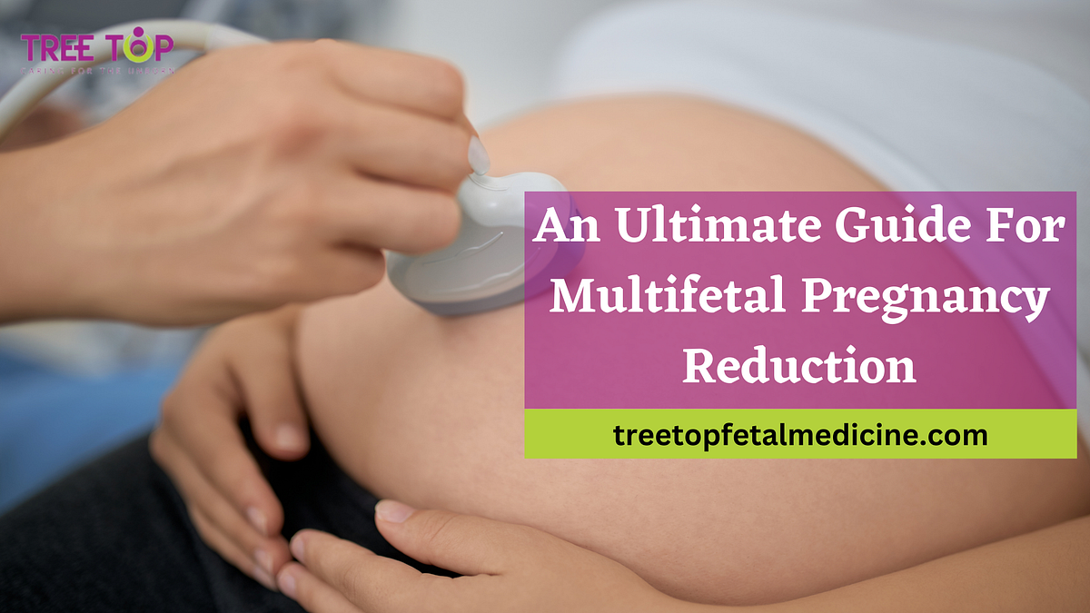 An Ultimate Guide to Multifetal Pregnancy Reduction | by Treetop Fetal Medicine | Medium