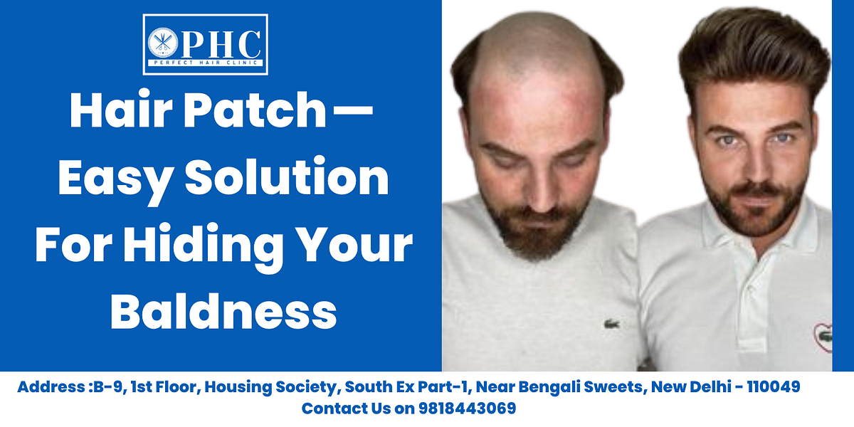 Hair Patch — Easy Solution For Hiding Your Baldness | by Perfect Hair ...