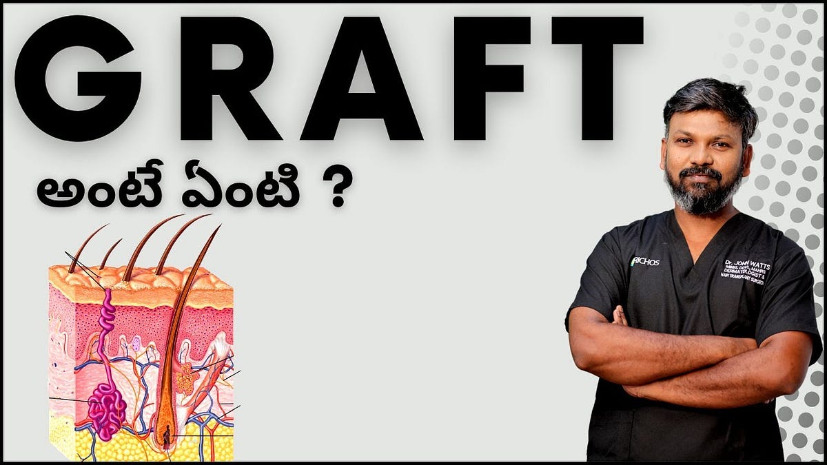 What is a Graft ? | Best Hair Specialist in Hyderabad Explains | by Dr ...