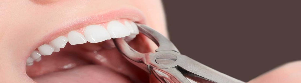 Best Suggestion for an Infected Tooth! Tooth Extraction | by Dental ...