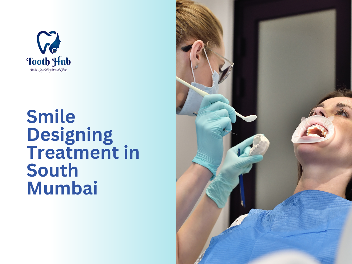 Learn about the best Smile Designing Treatment in Kemps Corner | by Tooth Hub Dental Clinic | Medium