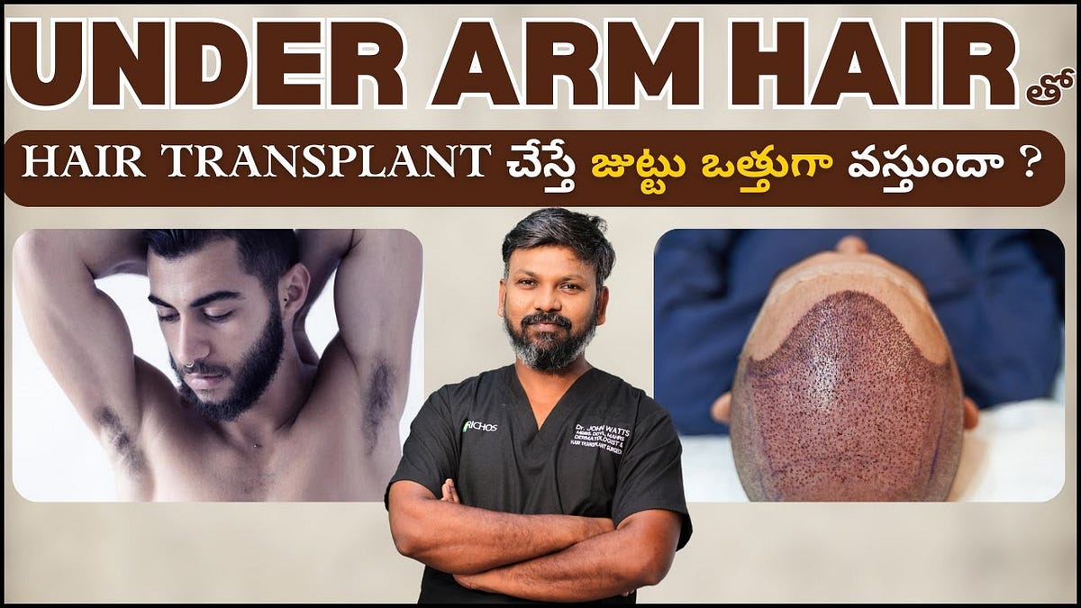 What are the disadvantages of using underarm hair as donor hair grafts ...