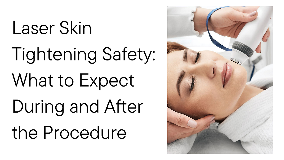 Laser Skin Tightening Safety: What to Expect During and After the ...