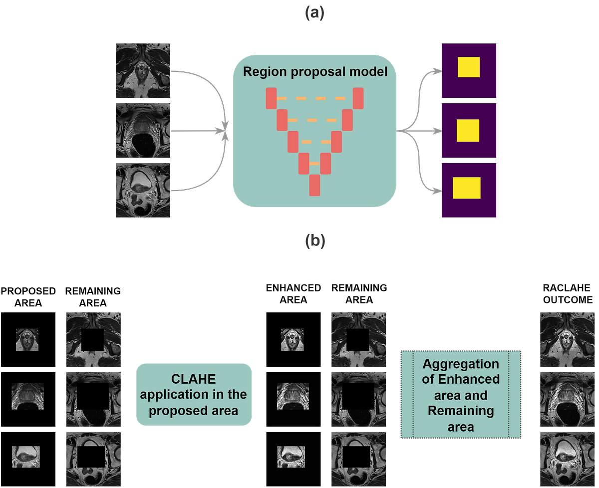 Region Adaptive Magnetic Resonance Image Enhancement for improving CNN based segmentation of the ...