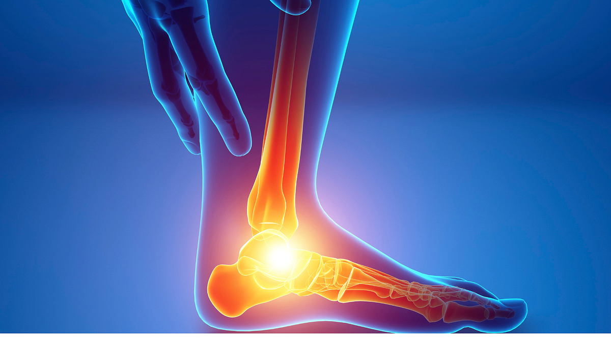 Time Bomb On My Feet: You Have It Too, and You’re Ignoring It. | by ...