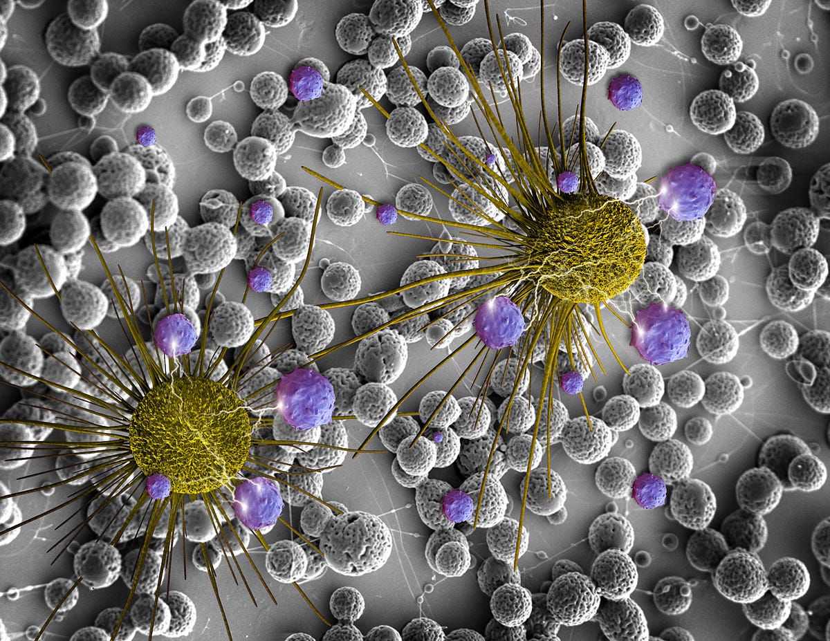 Does acidity cause cancer?. Acids, cancer, and the Warburg effect | by ...