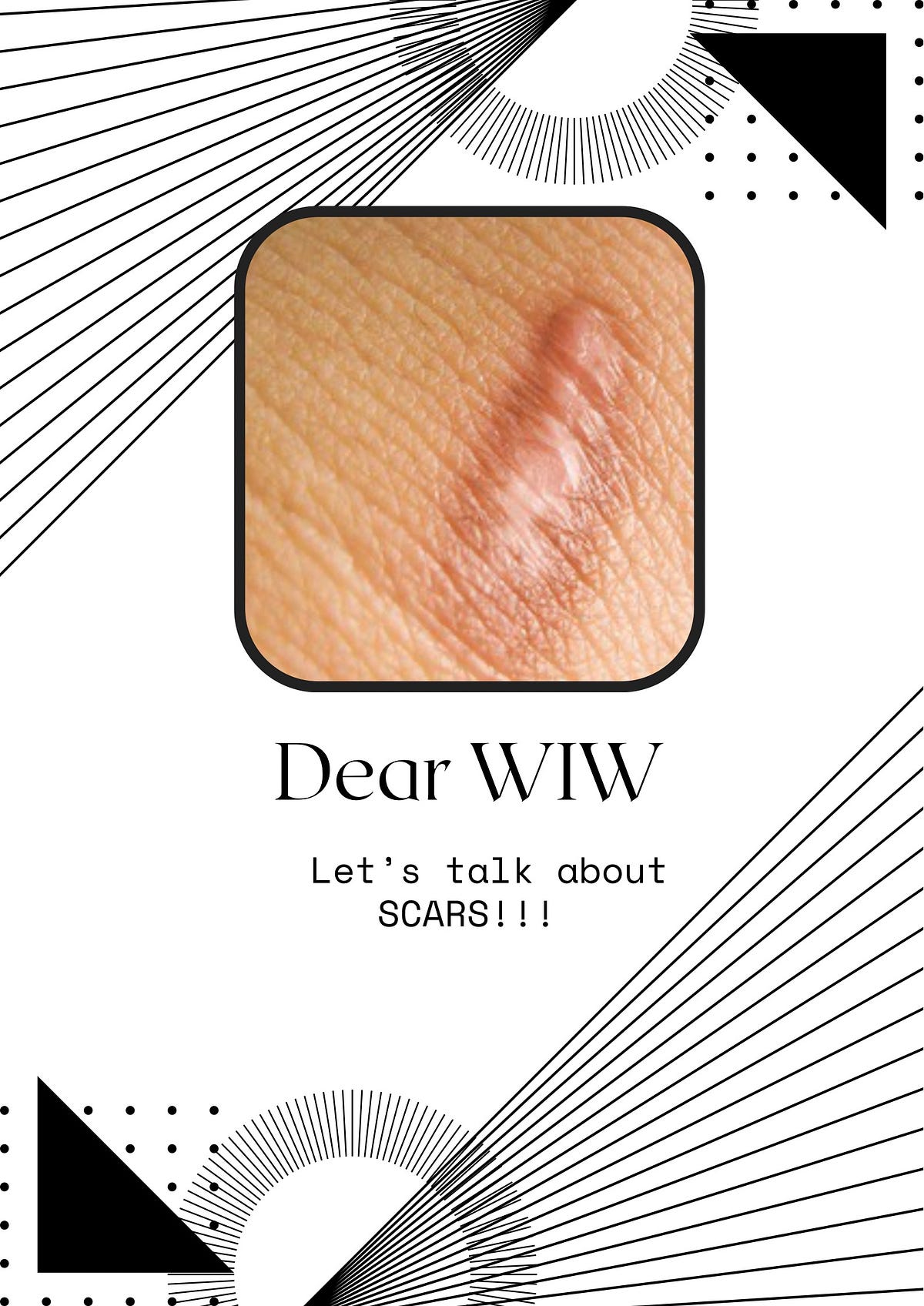 Dear WIW: Let’s talk about SCARS!!! | by FathersStoryTeller | Jul, 2023 ...