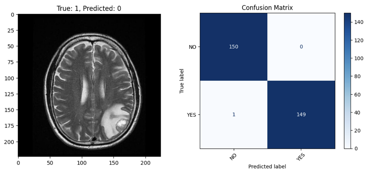 Brain Tumor MRI Classification. Reporter Moshu Huang | by Moshu | Medium
