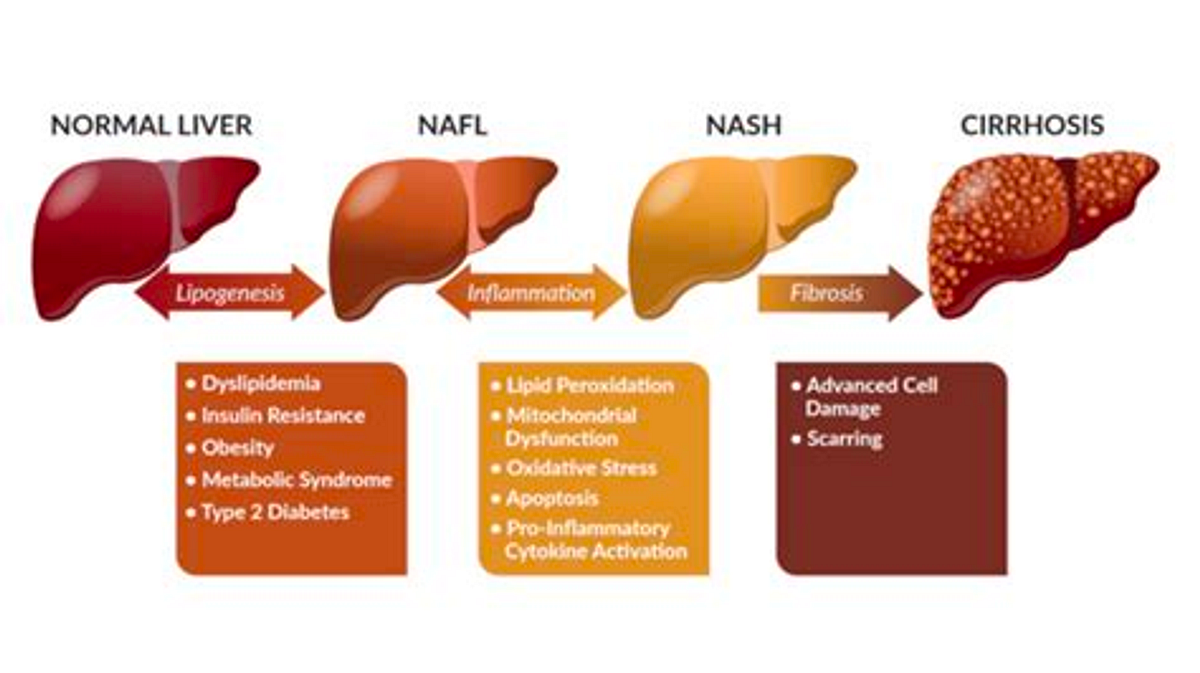 Fatty Liver: Diagnosis and Diagnostics | by Right Metabolic Path | May ...