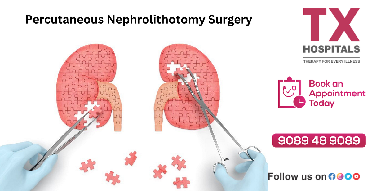 Percutaneous Nephrolithotomy Surgery in Hyderabad-TX Hospitals | by ...