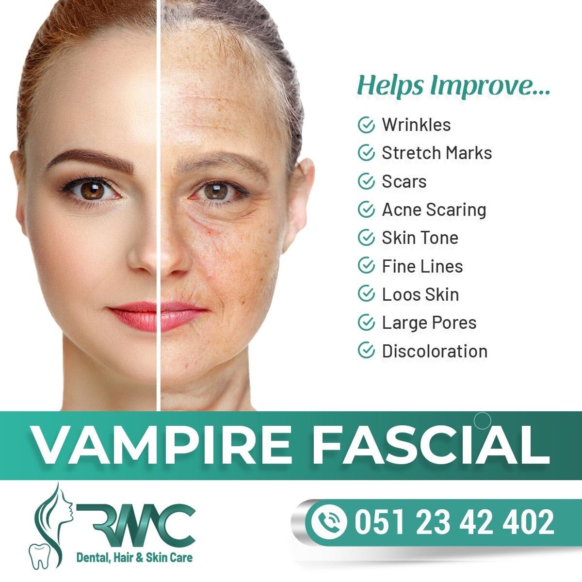 Vampire Facial Treatment in Islamabad, PRP- Rehman Medical Center ...