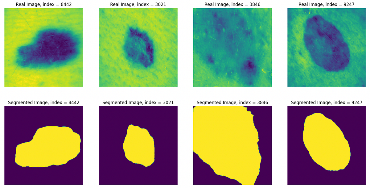 U-net Unleashed: A step-by-step guide on implementing and training your own segmentation model ...