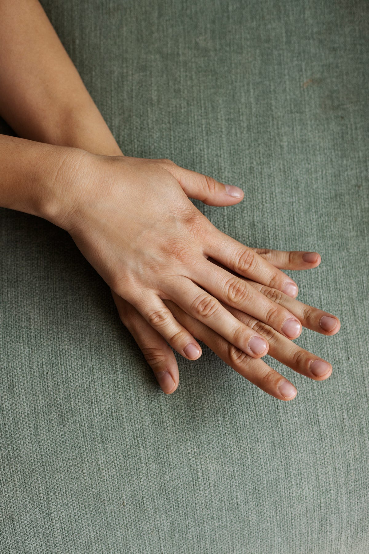 How to treat and prevent cracked skin around nails ...