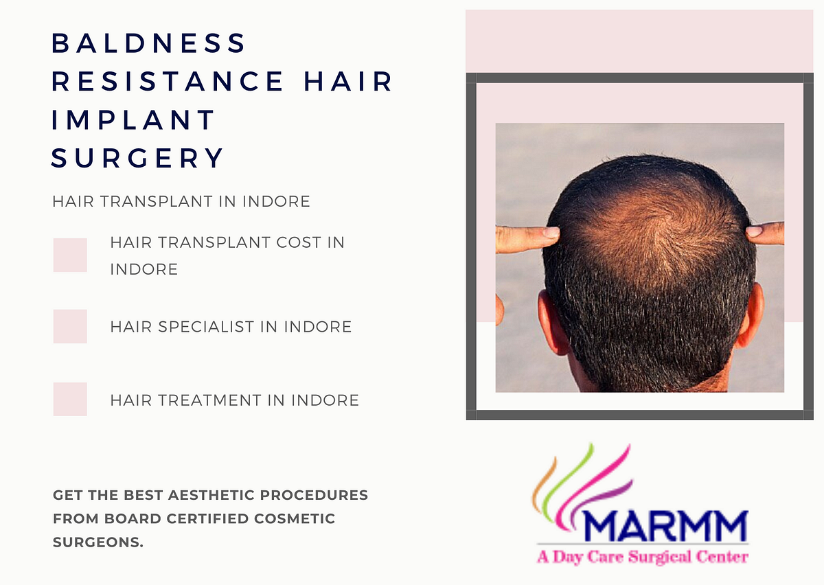 Baldness Resistance Hair Implant Surgery | Hair Transplant in Indore ...