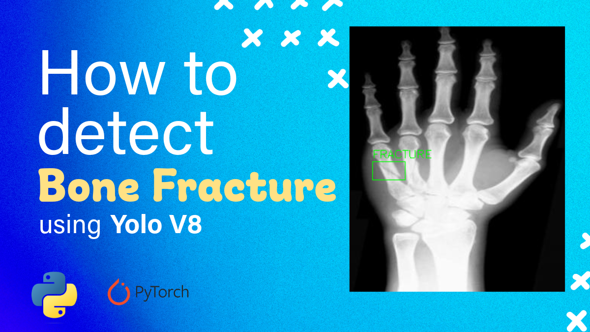 How to train YOLOv8 bone fracture detection on X-rays | by Eran Feit ...