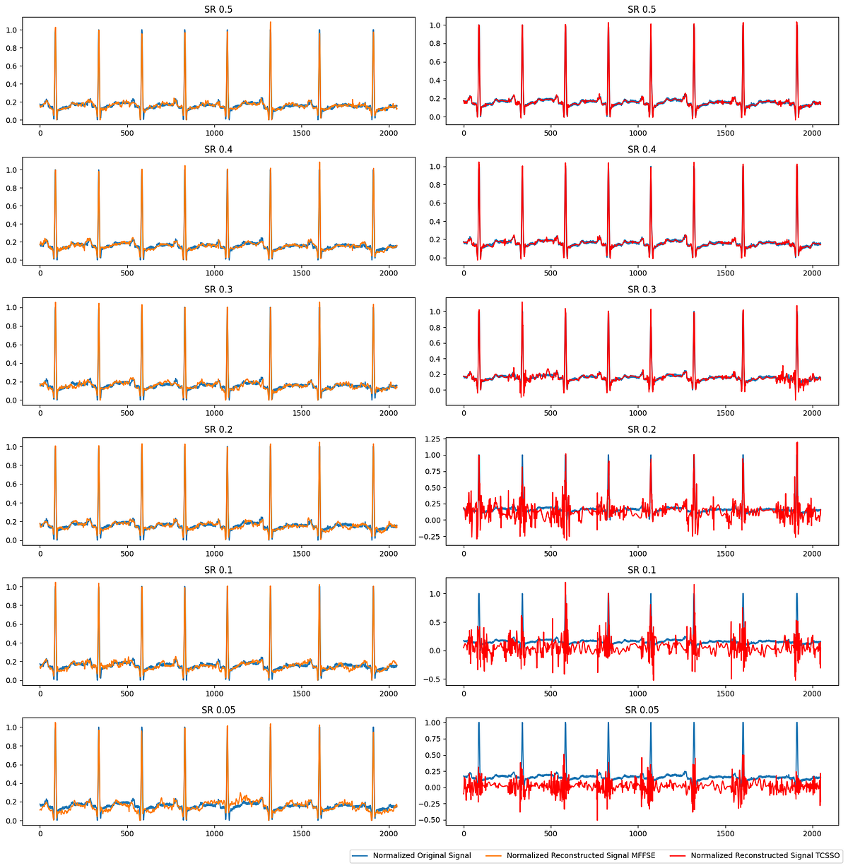 Beyond the Wires: Deep Compressive Sensing Brings AI to Wearable ECG ...