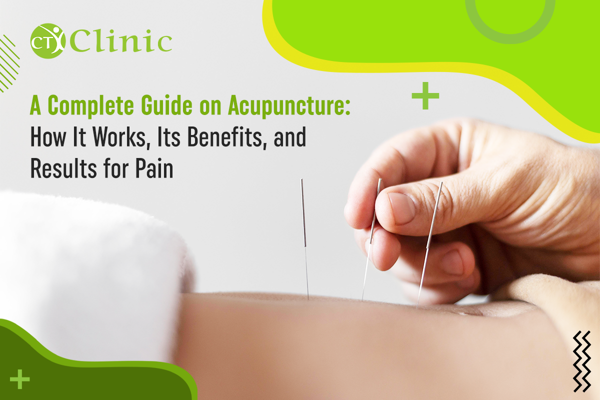 A Complete Guide on Acupuncture: How It Works, Its Benefits, and ...