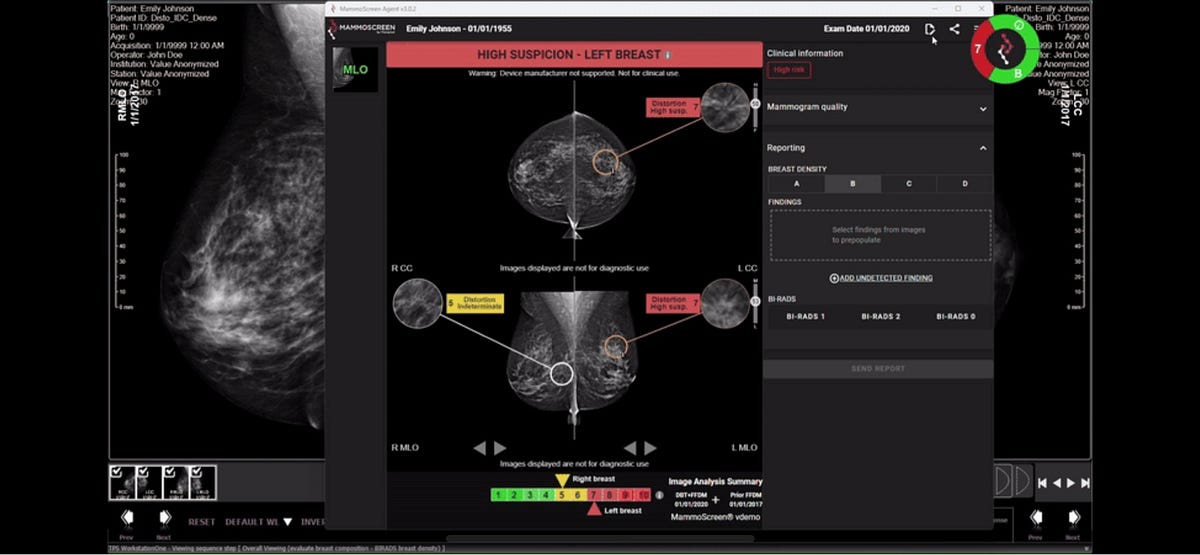 AI-Powered Radiology: How Traditional Mammography, MRI, CT, and ...