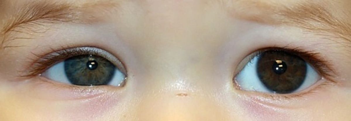 What are some common eye diseases that can affect newborns ...