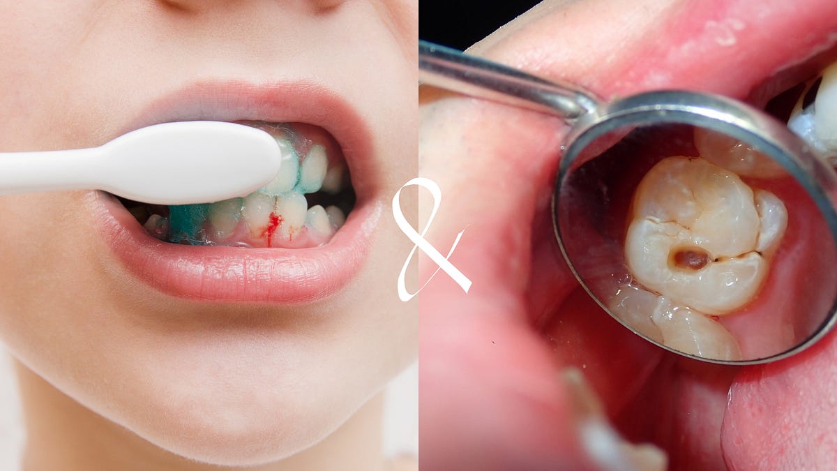 Discover the Miracle of Algae: A Natural Solution for Gum Bleeding and ...