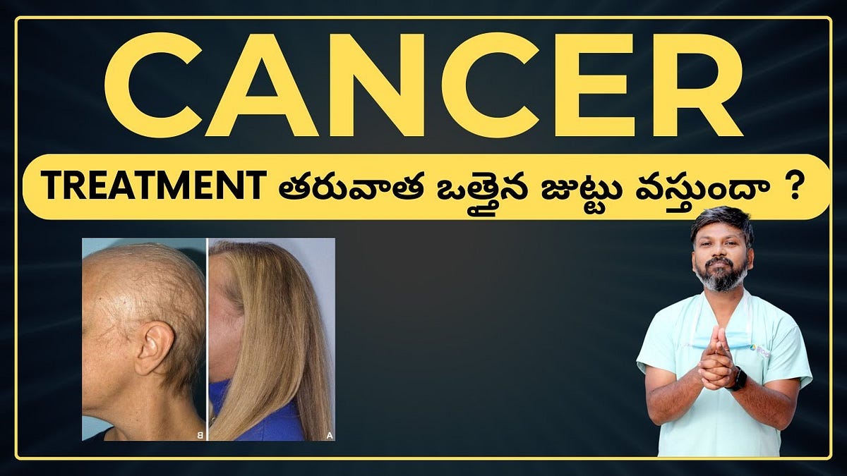 What are the options available for cancer patients to tackle hair loss ...