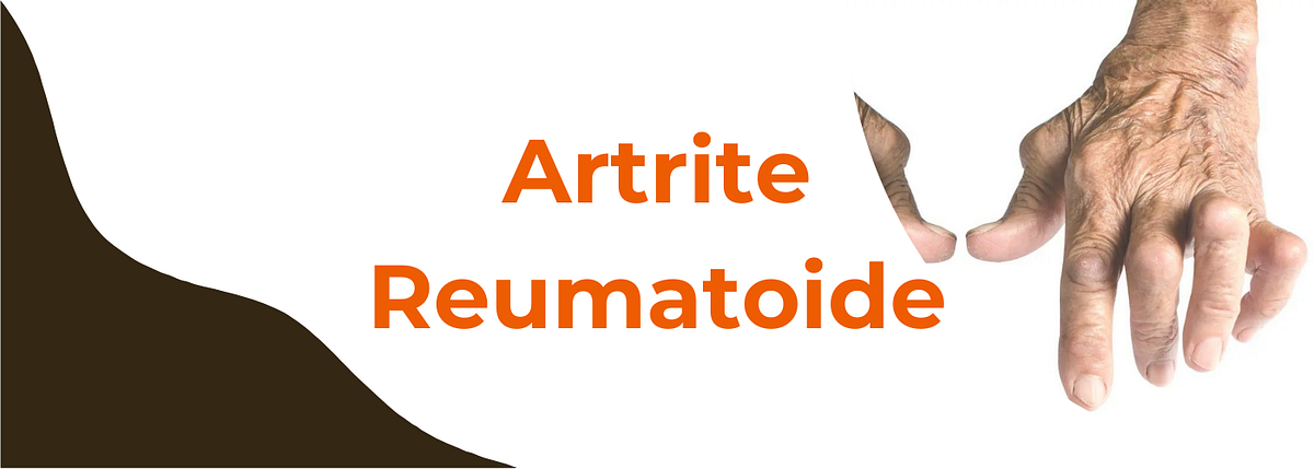 Artrite Reumatoide: O Guia Completo para Entender, Diagnosticar e ...