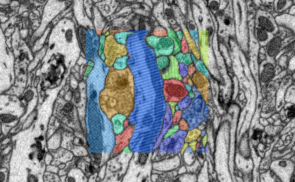 Annotation techniques for large-scale volume EM datasets | by Norman ...