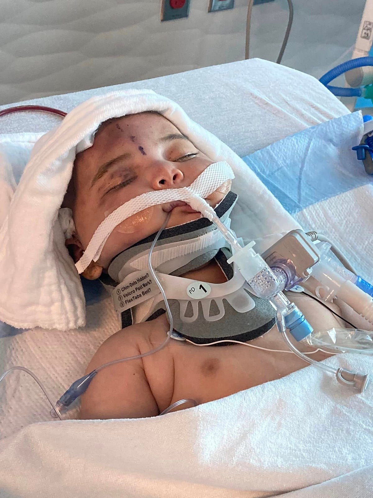 #Justice4Renzi Mother’s Girlfriend Arrested for Allegedly Beating 4 ...