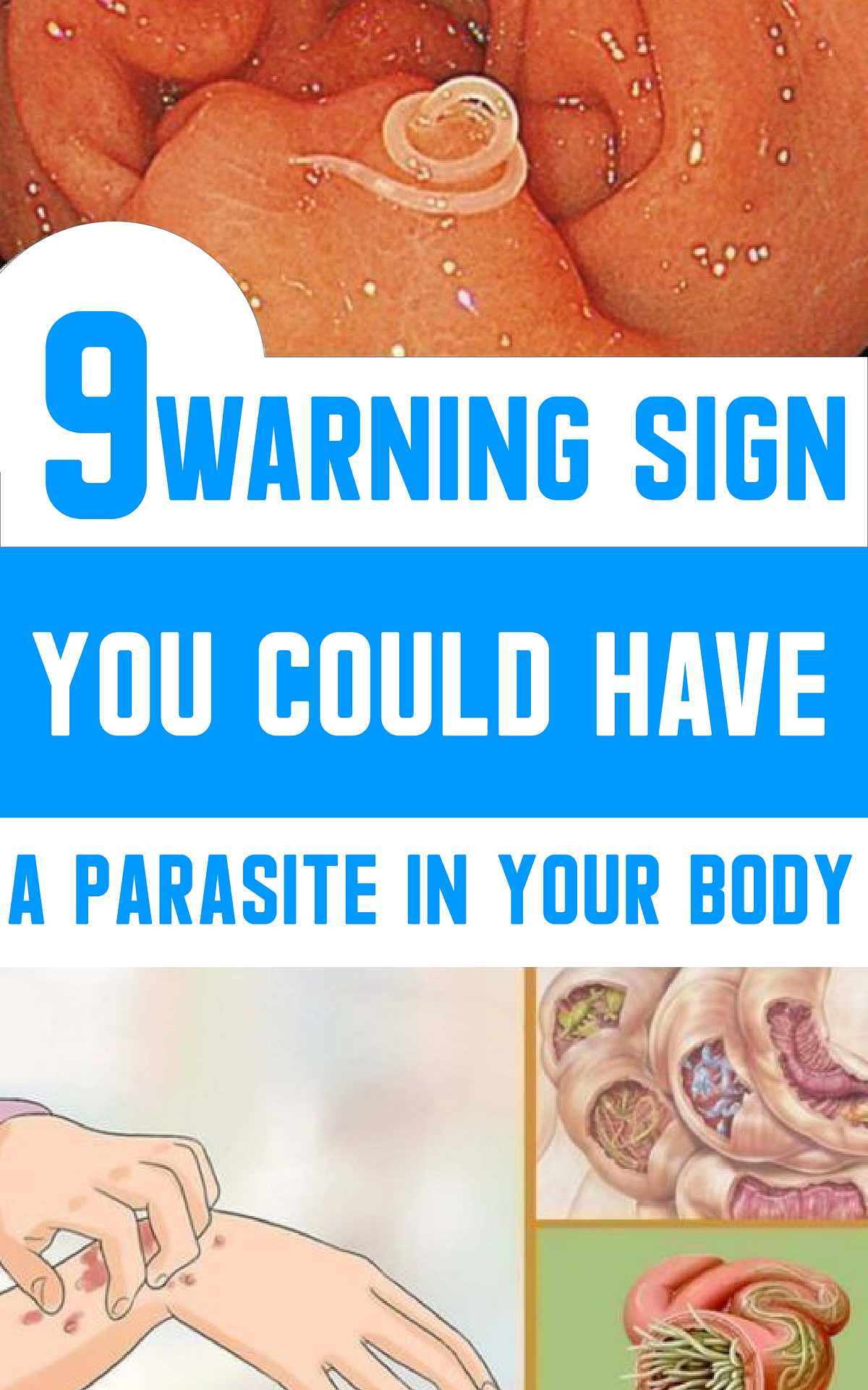 9 WARNING SIGN YOU COULD HAVE A PARASITE IN YOUR BODY - Jeromedhoffer ...