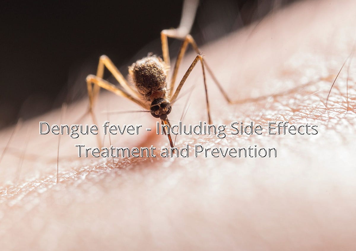 Dengue fever — Including Side Effects Treatment and Prevention: - Emad ...
