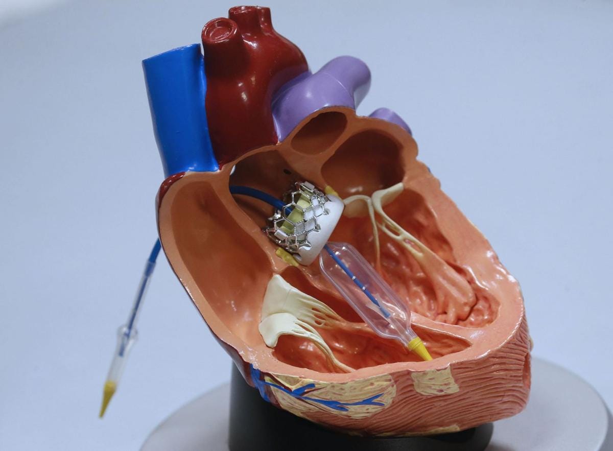 Dr Sanjay Kumar explains risks, precautions, process, and tips of Valve ...