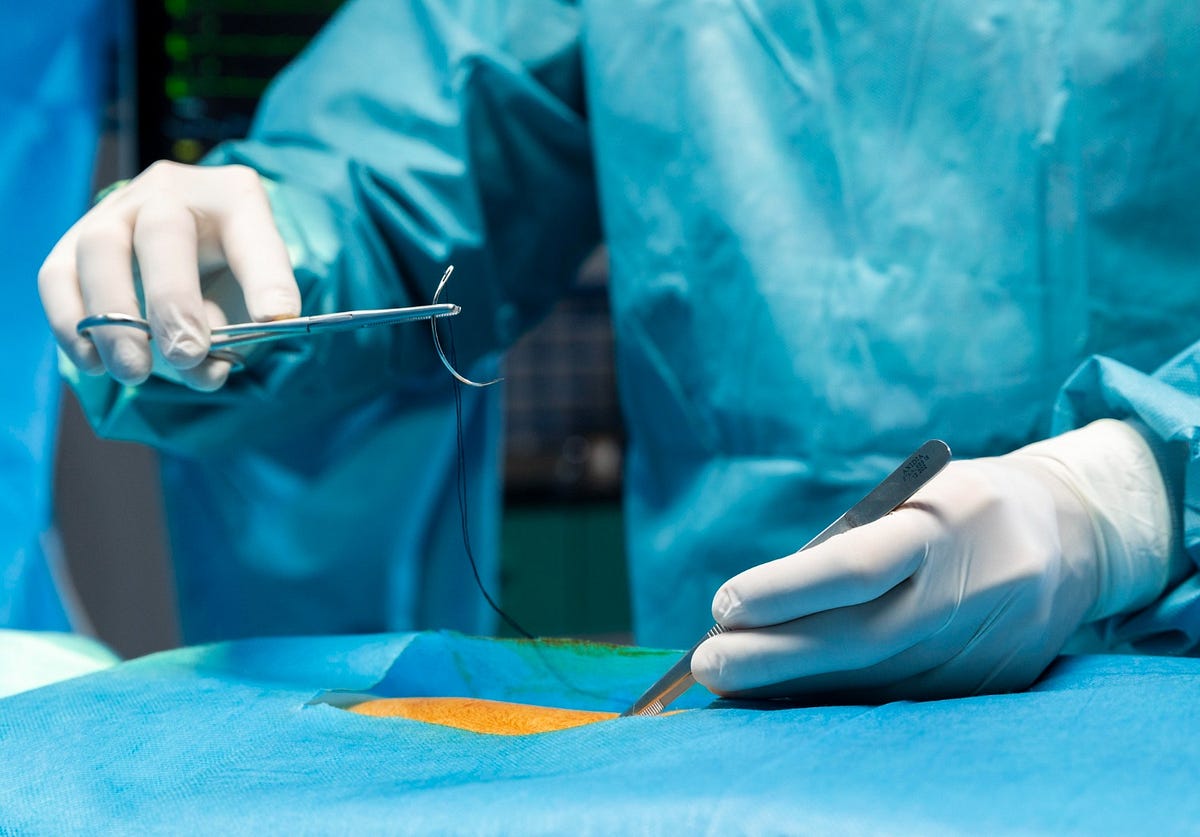 Stitching Excellence: Orion Sutures | Orion Sutures Blog