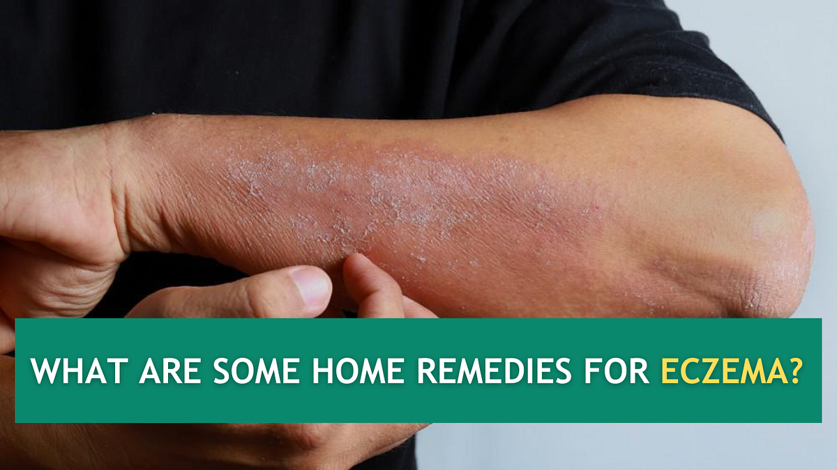 What are Some Home Remedies for Eczema? | by Dr. Sahil Gupta | Medium