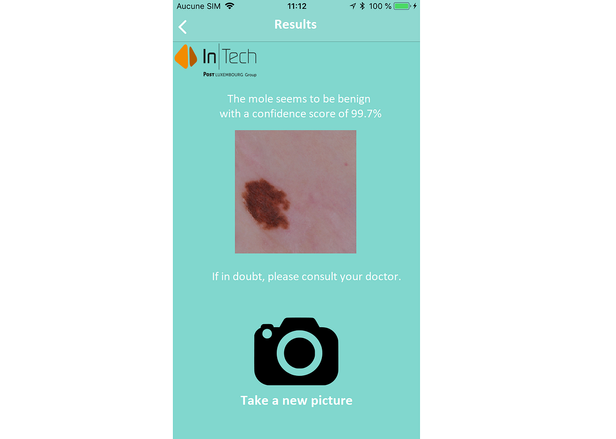 Detect mole cancer with your smartphone using Deep Learning | by ...
