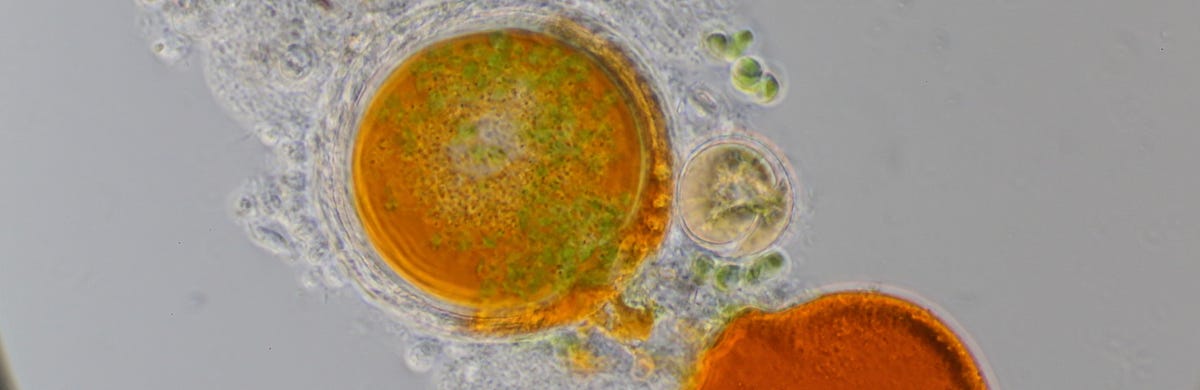 1. Introducing Snow Algae Reports | by Lynne Quarmby | Snow Algae ...