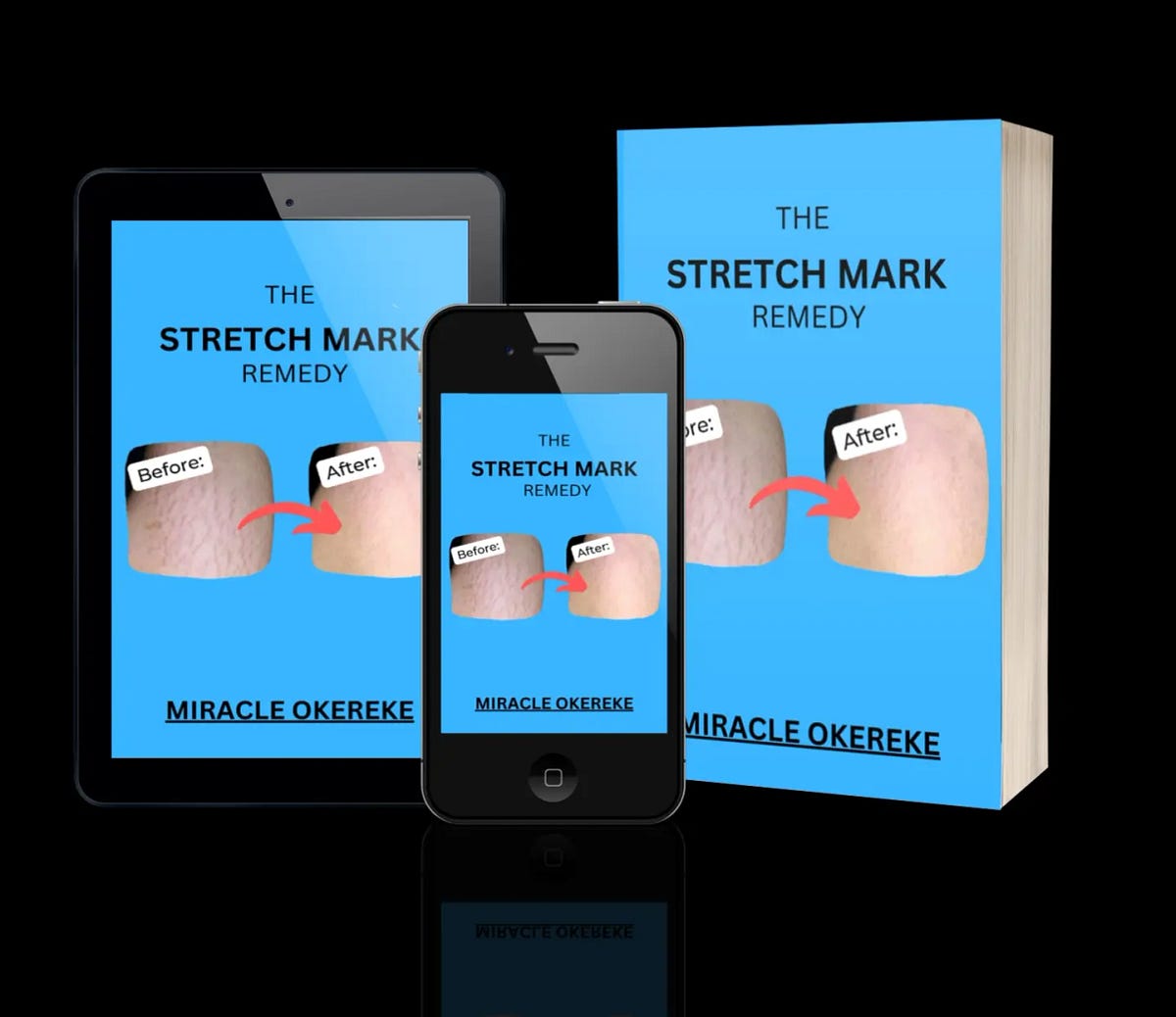 Stretch marks can change the way a person feels about their body ...