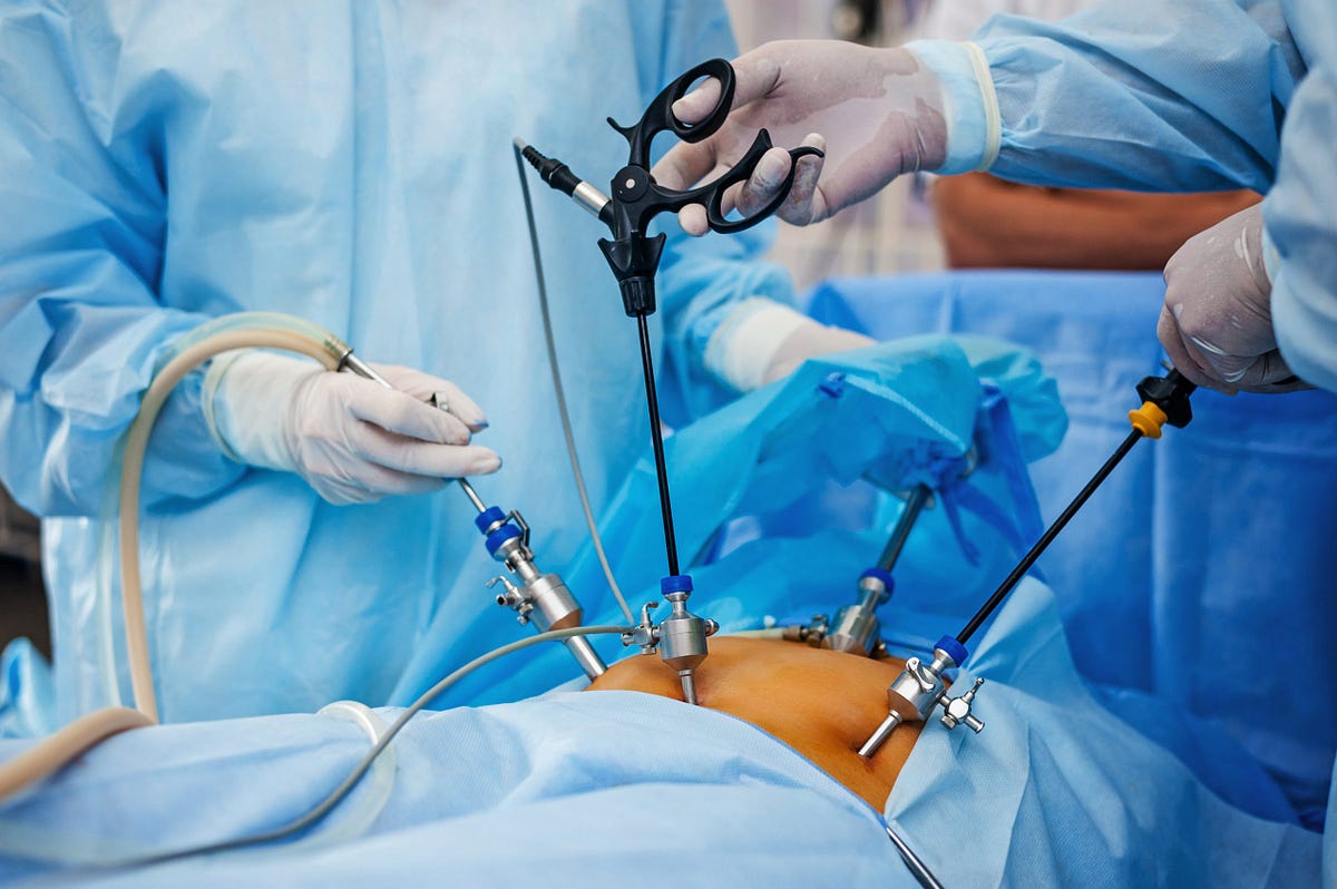 Best Surgery hospital in Kota. What is a Laparoscopy Surgery and why ...