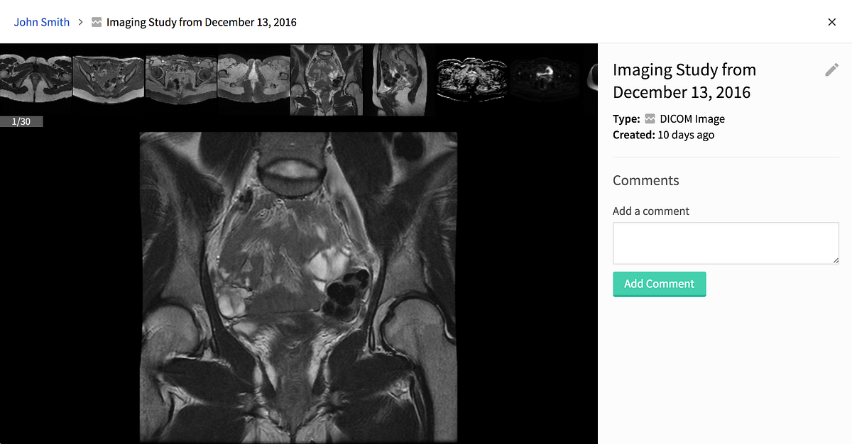 Introducing the PatientBank DICOM viewer | by Emma Rastatter ...