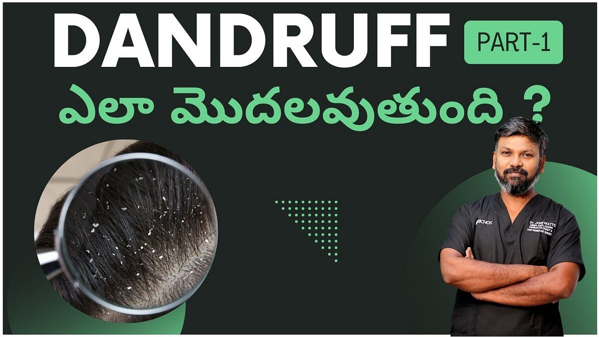 How can dandruff be permanently controlled? Are shampoos effective or ...